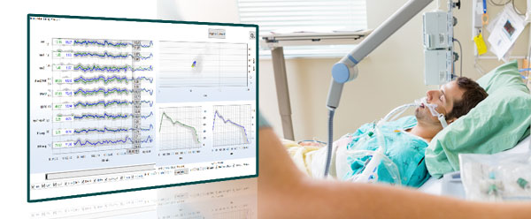 Neuromonitoring Analysis NMA - DWL