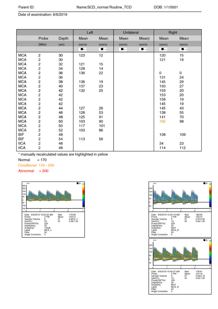 Sickle cell anemia and Sickle Cell Diagnostics - DWL