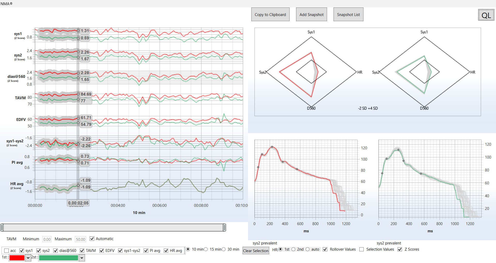 Neuromonitoring Analysis NMA - DWL
